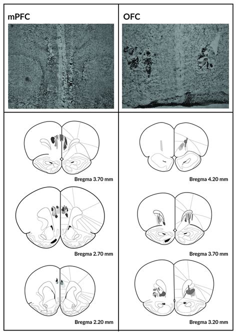 Histological Analysis Of The Mpfc And Ofc Lesions Photomicrographs Download Scientific Diagram