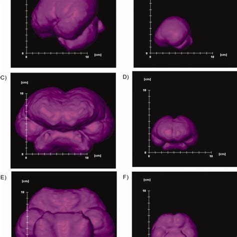 Three Dimensional Reconstructions Of The Subadult And Fetal Brain From