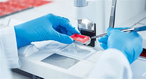 Hot Selling Histology Cassette Single Use Plastic Embedding Cassette