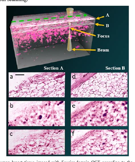 Figure 4 From Computational Optical Coherence Tomography [invited