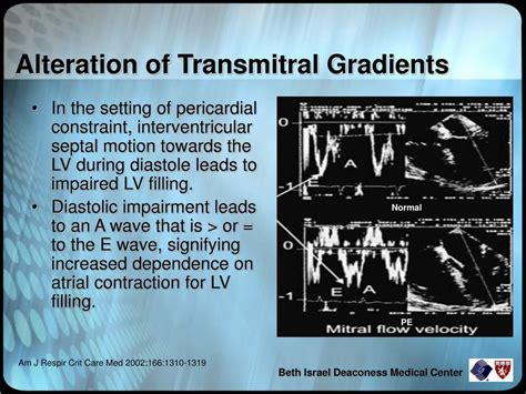 Ppt Echocardiography In Pulmonary Embolism Powerpoint Presentation