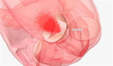 Premium Photo Normal Aortic Valve Function