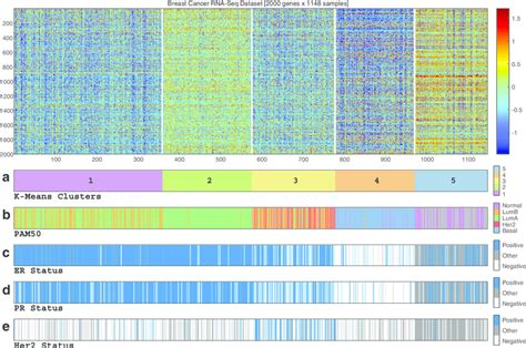 Global Unsupervised Clustering Of 1148 Breast Samples Using Rna Seq