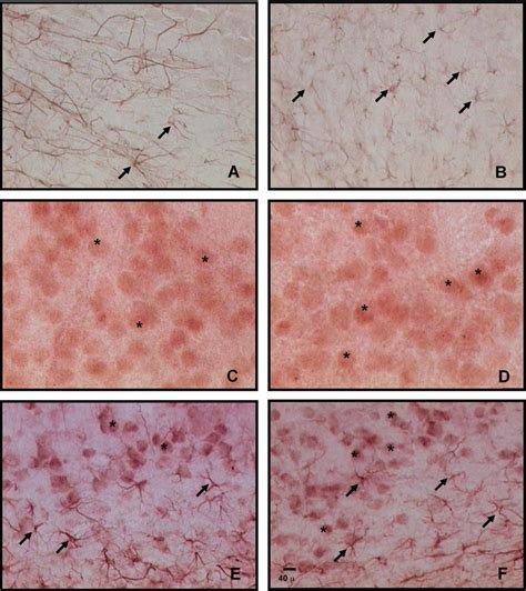 Immunohistochemistry For Tnf A In The Cerebral Cortex Of Rats At Eighth Download Scientific
