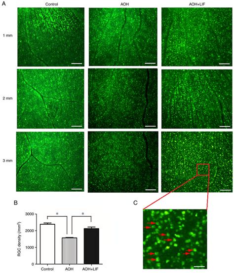 Fg Retrograde Labeling To Determine The Effects Of Lif On Rgc Survival