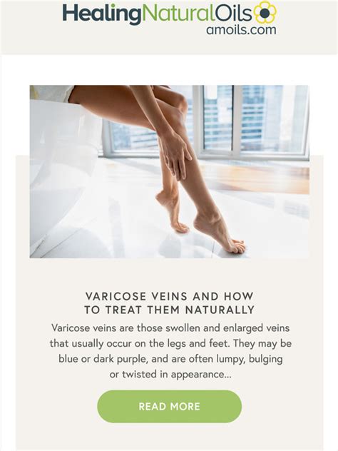 Healing Natural Oils Varicose Veins And How To Treat Them Naturally Milled