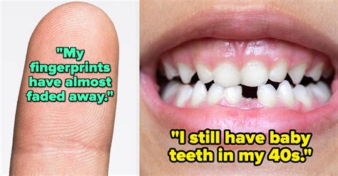 29 Rare Body Abnormalities People Live With
