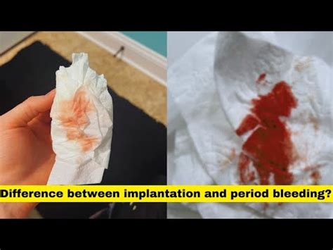 Implantation Bleeding Vs Period Implantation Bleeding Or Period