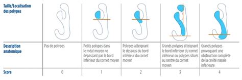 Quels Outils Pour évaluer La Polypose Naso Sinusienne