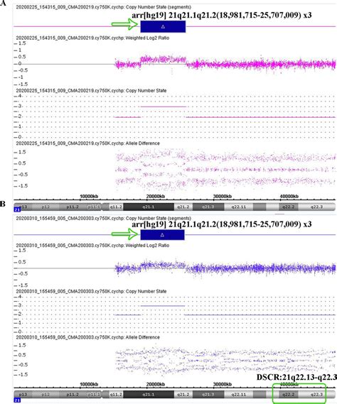 Chromosomal Microarray Analysis Showed A 67 Mb Duplication Of
