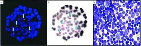 A Fish Metaphase From Analysis 1 The Arrows Indicate Four Copies Of