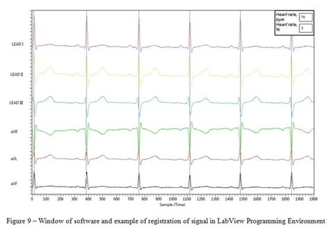 Algorithm Of St Interval Selection At Daily Monitoring To Assess