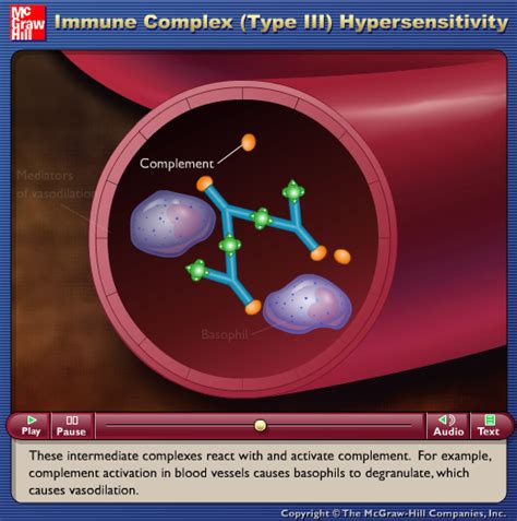 Immune Complex Type Iii Hypersensitivity Play Online On Flash Museum 🕹️