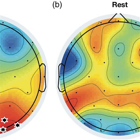 Scalp Topographies Of The Correlation Coefficient Between Peak Alpha Download Scientific