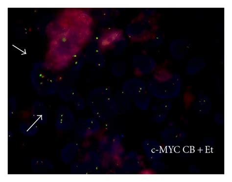 To Assess Whether Multiple Myc Signals Relied On Myc Gene Amplification