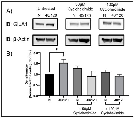 Ijms Free Full Text Sex Dependent Differences In The Ischemia