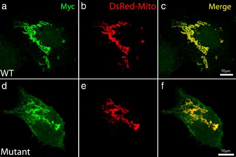 Co Localization Of Chchd10 With Mitochondria Hek 293 Cells Were