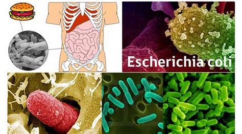 E Coli Escherichia Coli An Overview Microbe Notes