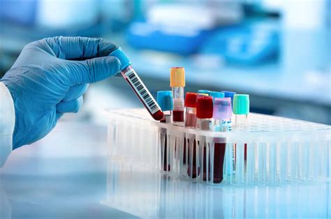 Common Medical Laboratory Errors To Look Out For Crandall And Pera Law Llc Medical Malpractice