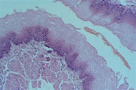 Gi Histology Flashcards Quizlet