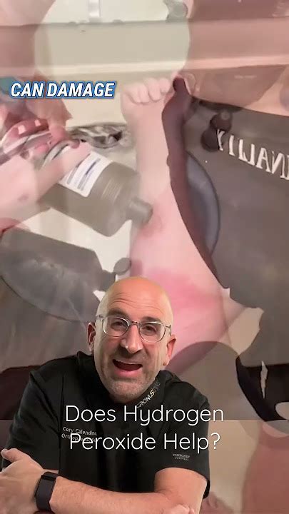 Hydrogen Peroxide Uses For Cleaning Wounds 시네21