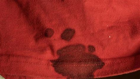 How To Remove Blood Stains