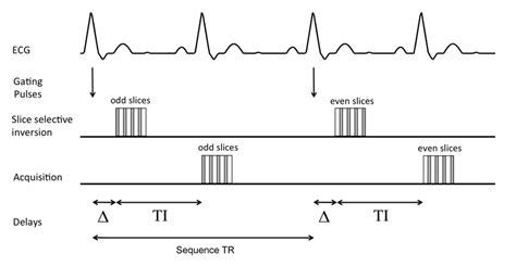 Schematic Representation Of The Acquisition Strategy For Our Inversion