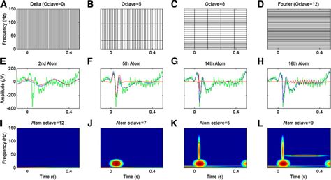 Comparison Of Matching Pursuit Algorithm With Other Signal Processing Techniques For Computation