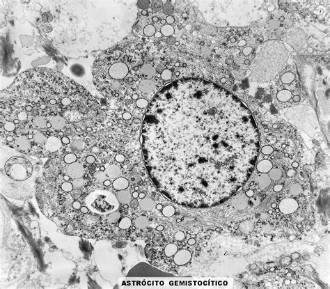 What Is Transmission Electron Microscopy Artofit