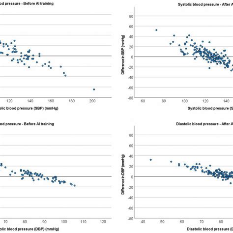 Bland Altman Plots For Pulse And Respiration Rate Comparing The Camera Download Scientific