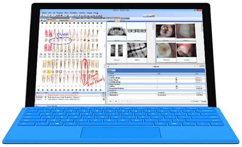 Xlchart Electronic Dental Records System Paperless Dental Record