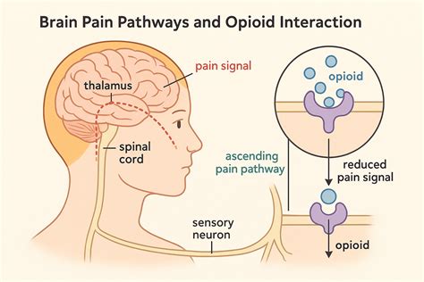 When And How Opioids Can Cause Muscle Aches And What To Do About It