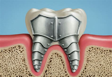 Strengthen Weak Tooth Enamel For A Healthier Confident Smile