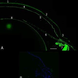 TM Localization In The Anterior Segment Of The Murine Eye A The Download Scientific Diagram