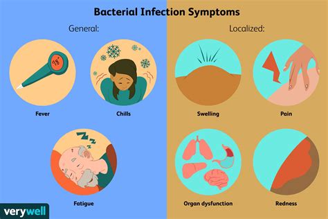 Viral Infection Symptoms