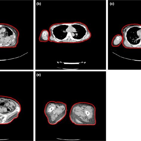 Images Showing Results Of Contouring Based On The New Improved