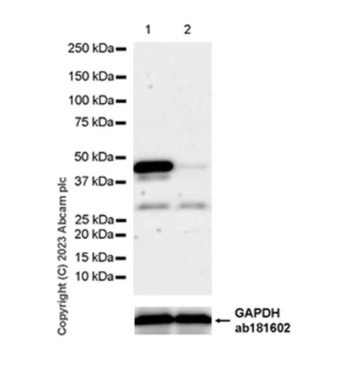 Anti Caspase 12 Antibody Epr27005 83 Ab315271 Abcam