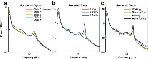 Finely Tuned Gamma Oscillations Across The Motor System In Patients With Isolated Dystonia