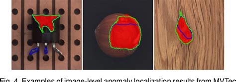 Figure From Self Supervised Masked Convolutional Transformer Block For Anomaly Detection