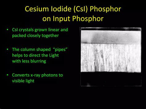 Fluroscopy Pptx Eye And Vision Conditions Diseases And Conditions