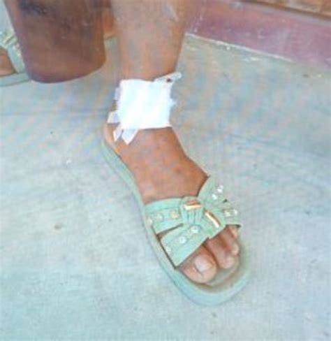 တောင်သာမြို့နယ်တွင် ပေါက်ကွဲမှုဖြစ်ပွားခဲ့ရာ စာမေးပွဲဖြေဆိုရန်သွားသည့် Grade 10 ကျောင်းသူ ၂ ဦး