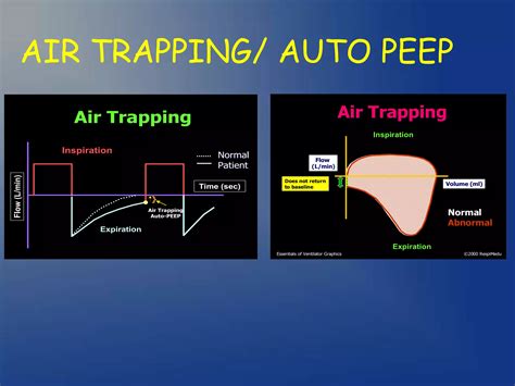 Ventilator Waveforms Dr Sanjay Chugh Pptx Lung And Respiratory Health Diseases And Conditions