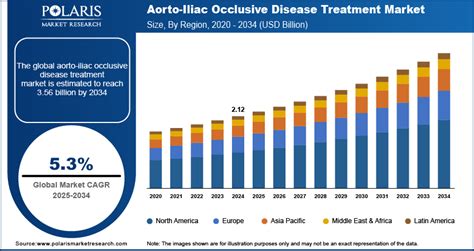 Aorto Iliac Occlusive Disease Treatment Market Forecast To 2034
