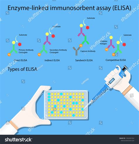 最佳 Enzyme Linked Immunosorbent Assay Elisa Immunoassay Eia Antibodies Infectious Technician