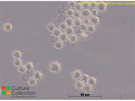 Acanthamoeba