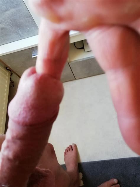 Dialator Pics XHamster