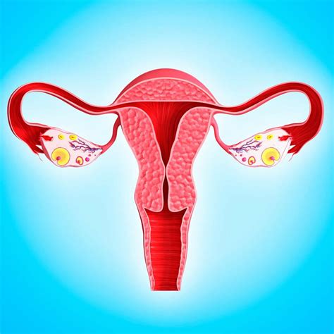 Polycystic Ovaries Symptoms Diagnosis Treatment Ultrasound And Diet