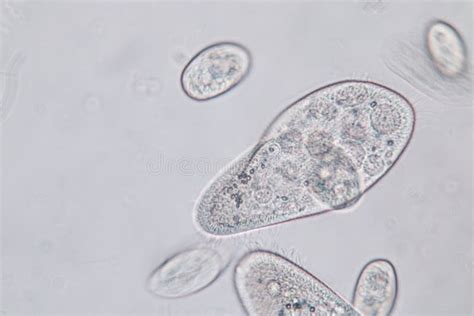 Protozoa Under Microscope 400x Photomicrography And Video Of Protozoa