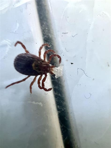 Tick On Scalp R Whatisthisbug