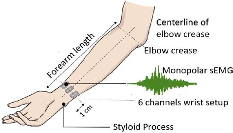 Figure 1 From Multi Day Analysis Of Wrist Electromyogram Based Biometrics For Authentication And